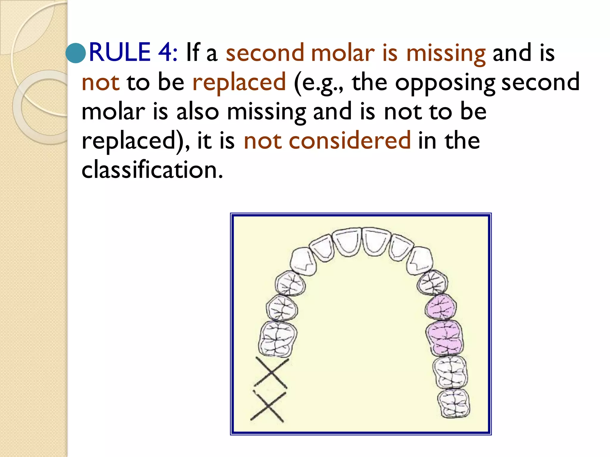 RPD Classification. | PDF