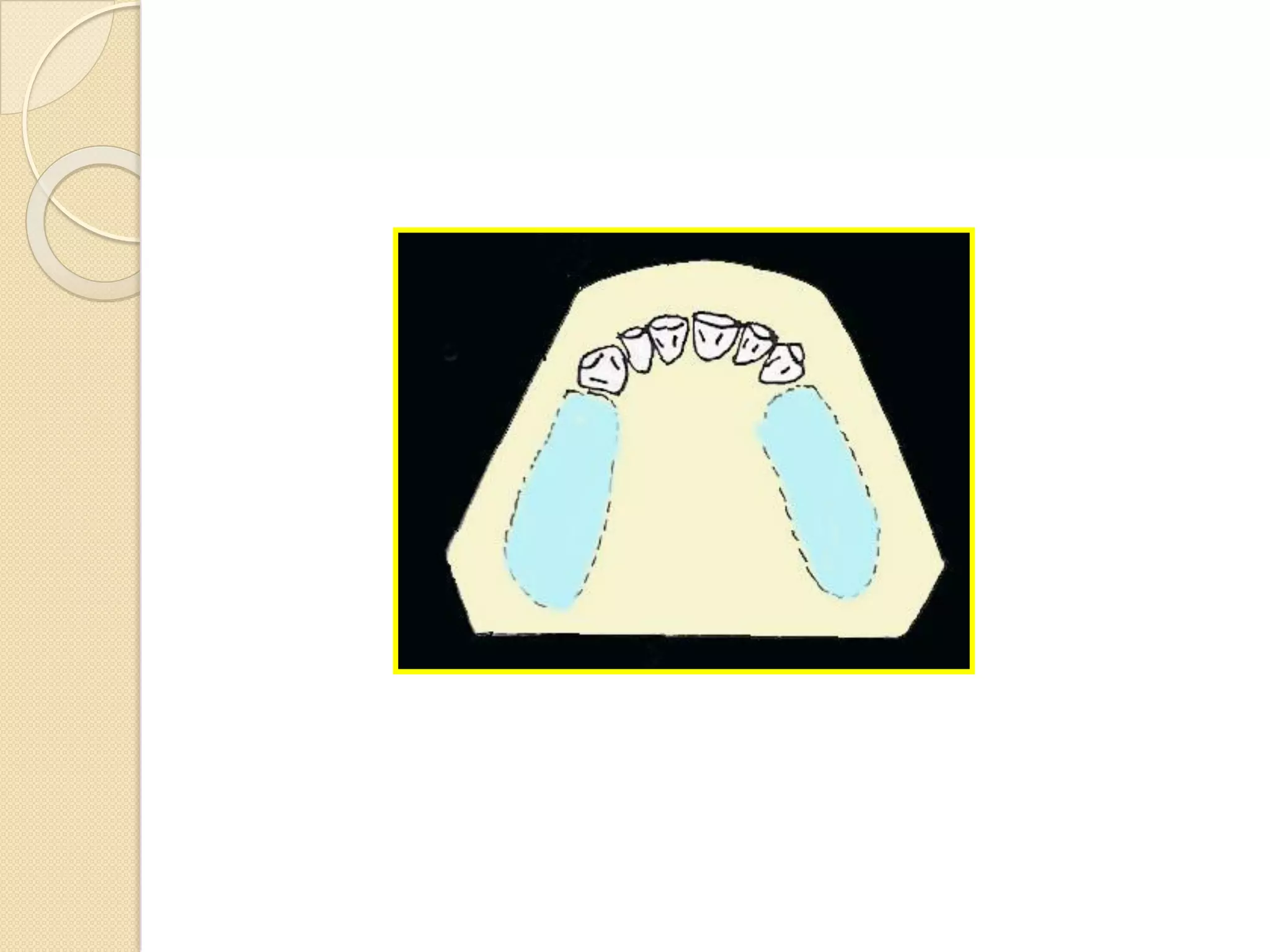 RPD Classification. | PDF