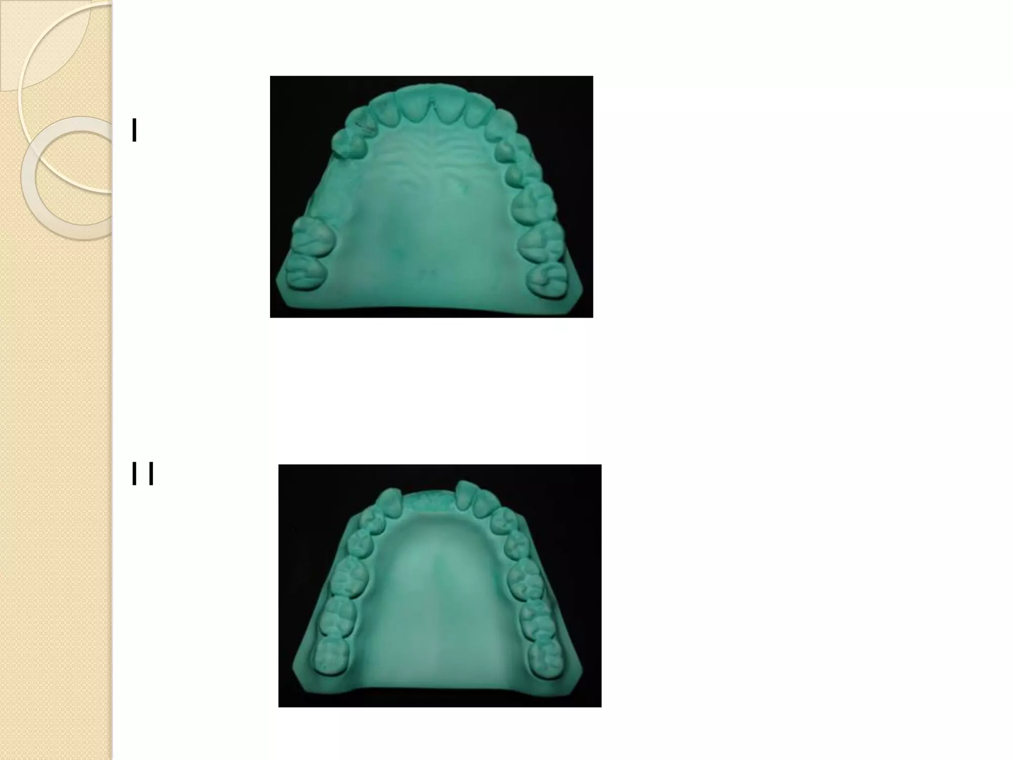 RPD Classification. | PDF