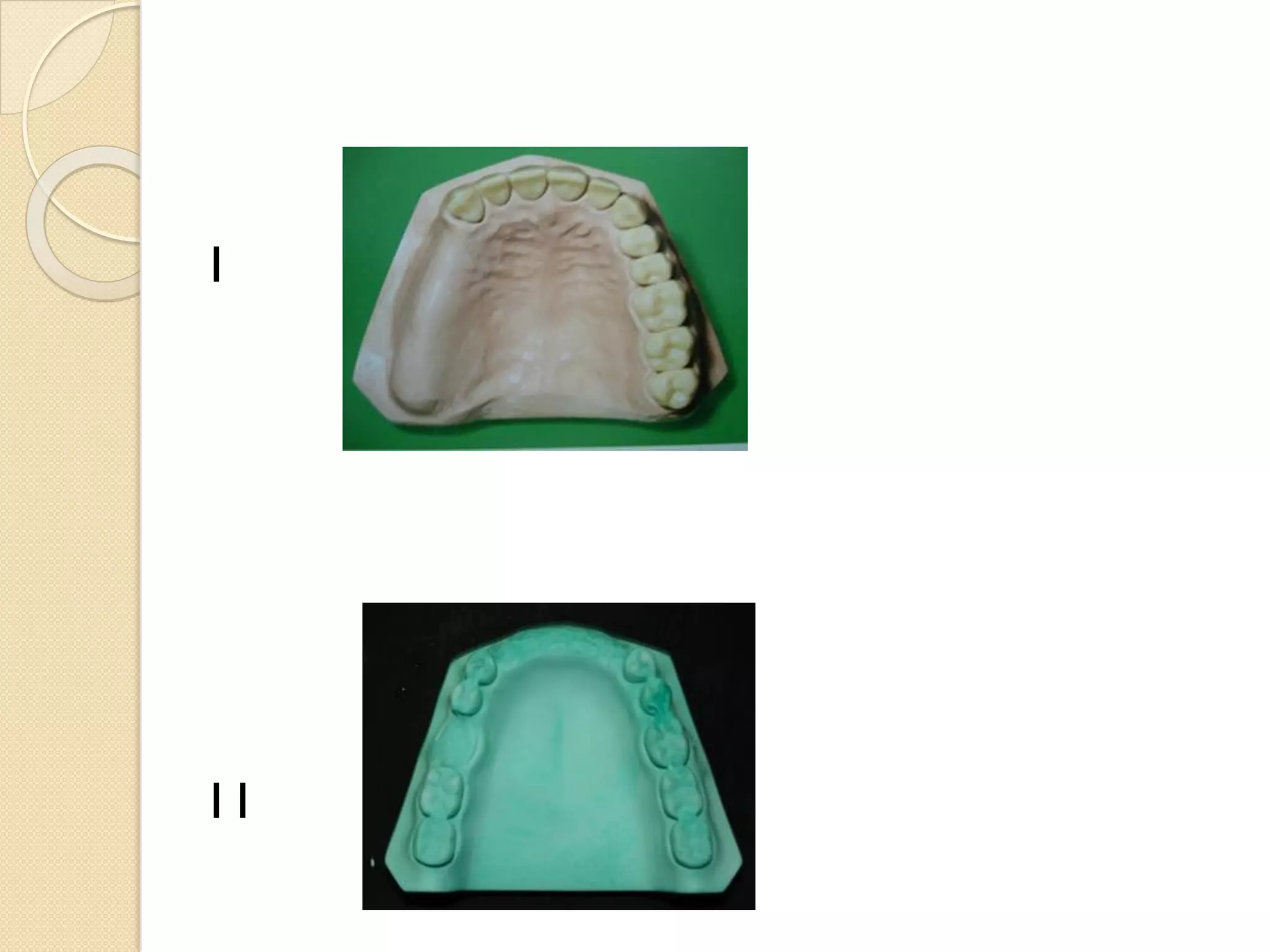 RPD Classification. | PDF