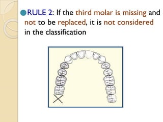 RPD Classification. | PDF