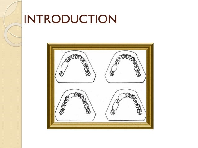 RPD Classification. | PPT | Free Download