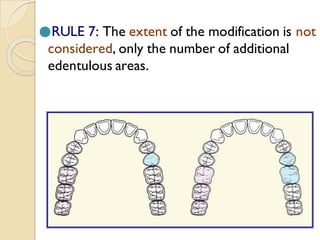 RPD Classification. | PDF