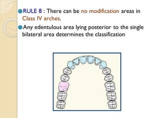 RPD Classification. | PDF