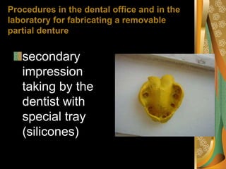 removable partial denture rpd classification.pdf