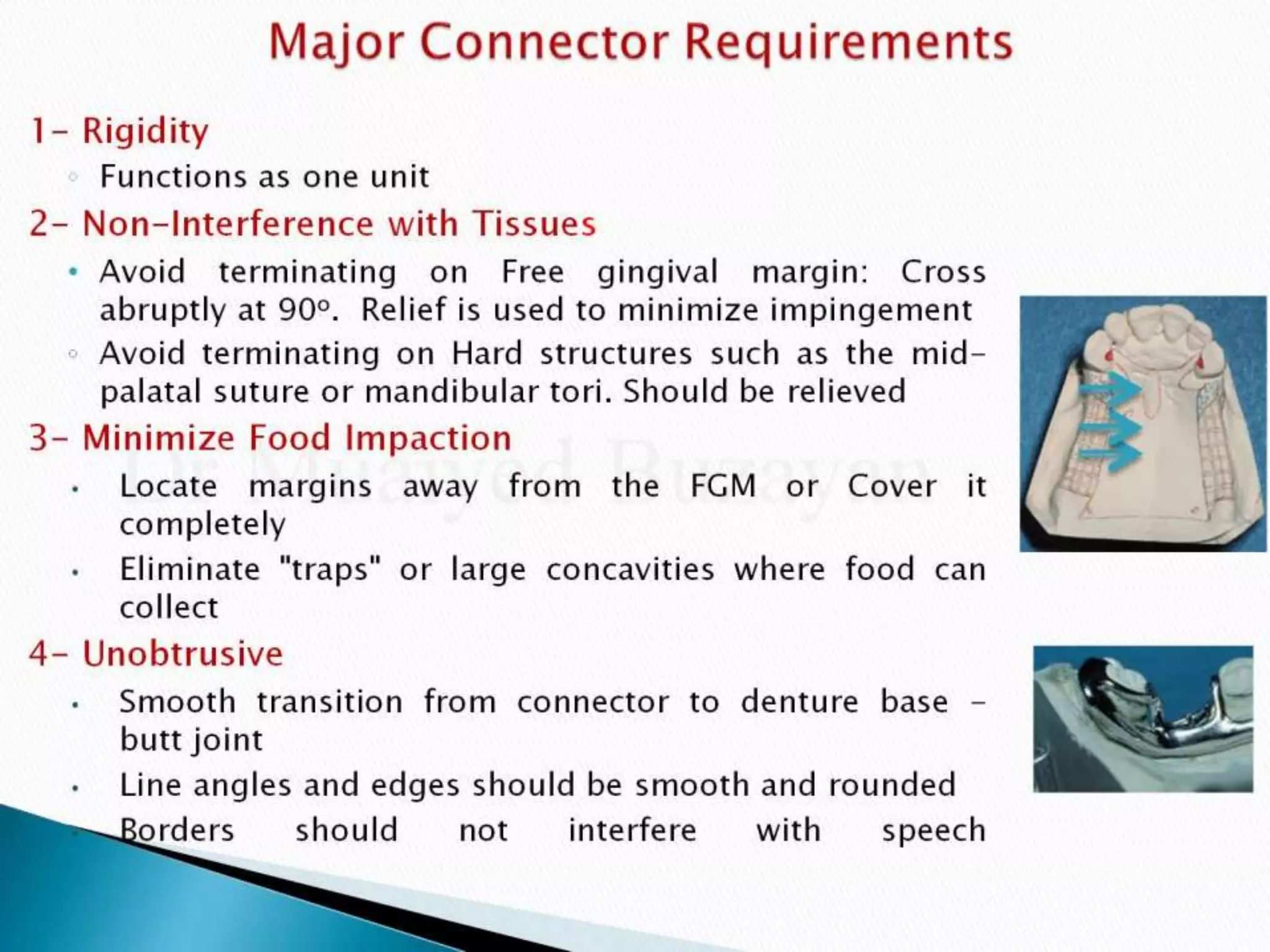Rpd component + major connectors 2nd yr | PPT