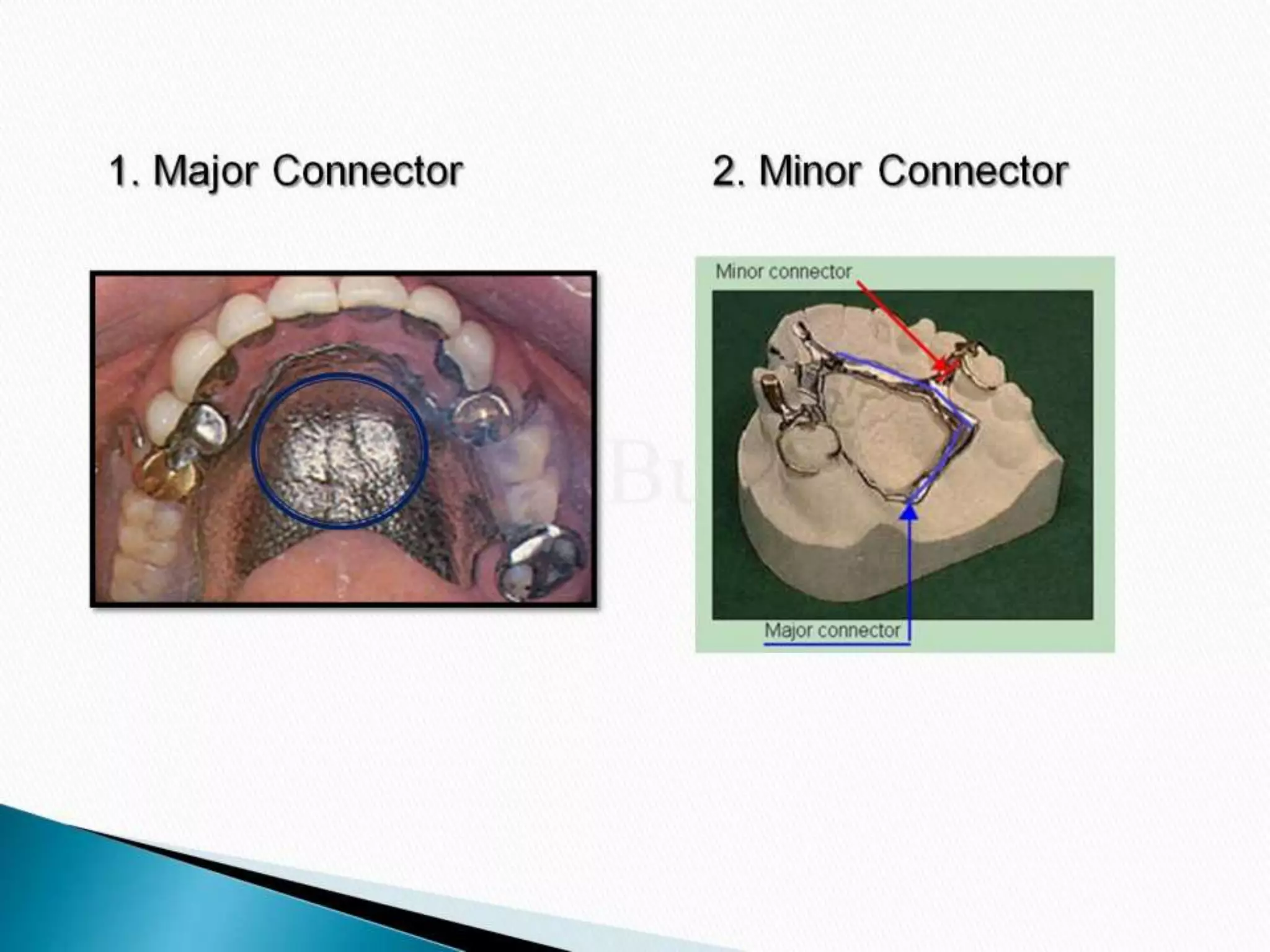 Rpd component + major connectors 2nd yr | PPT