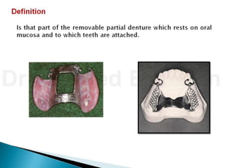 Rpd denturebases 2nd yr | PPTX