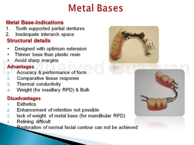 Rpd denturebases 2nd yr | PPT