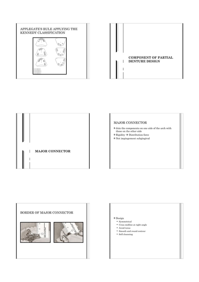 Rpd design | PDF | Oral care | Personal Care