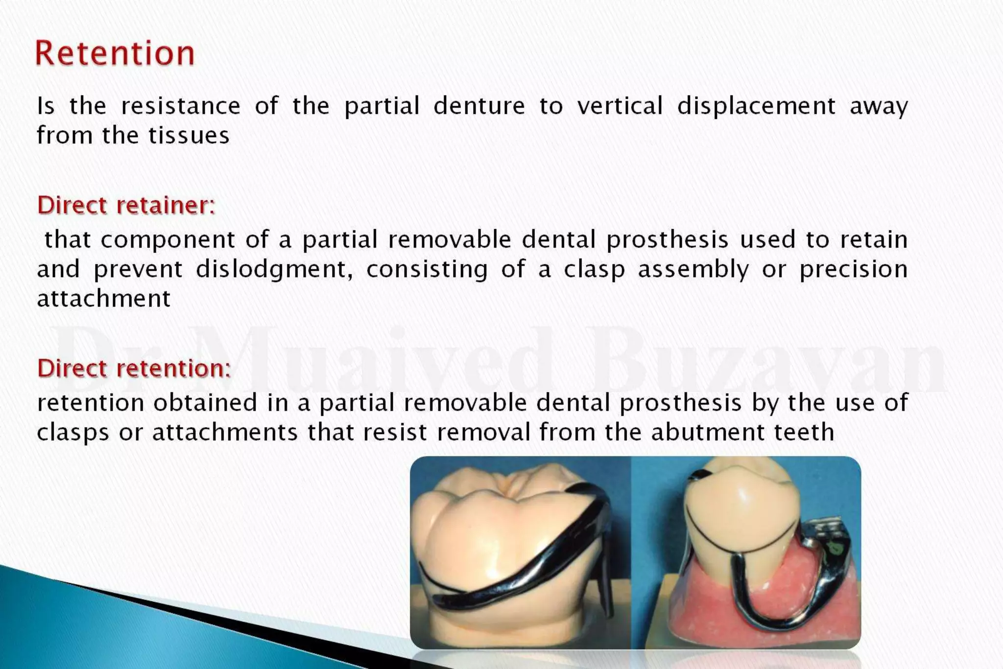 Rpd direct retainers 2nd yr | PPTX