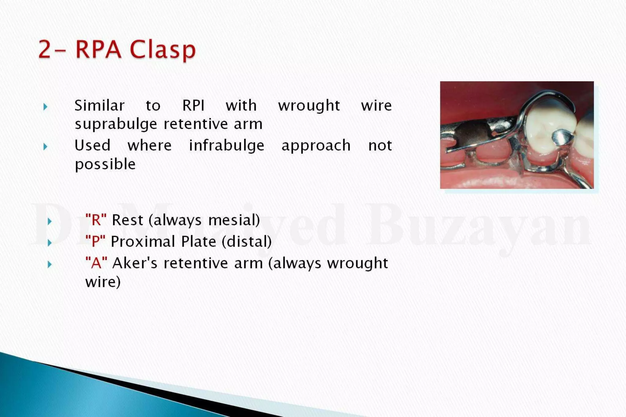 Rpd direct retainers 2nd yr | PPTX