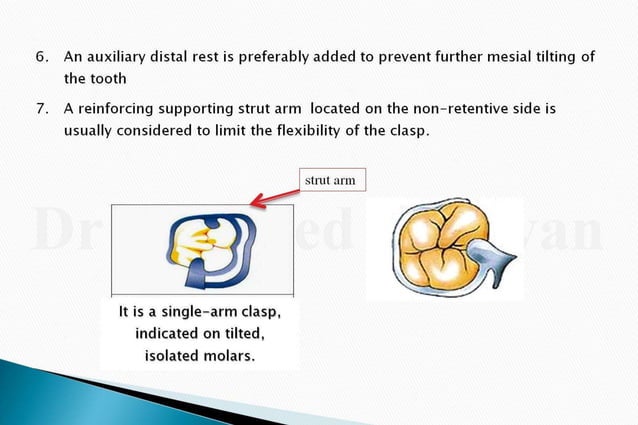Rpd direct retainers 2nd yr | PPTX