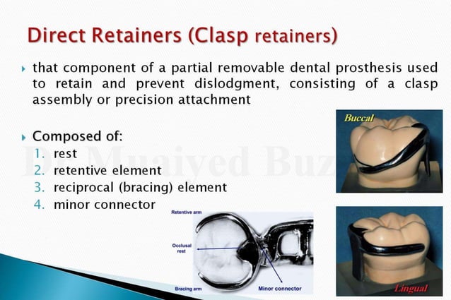 Rpd direct retainers 2nd yr | PPTX