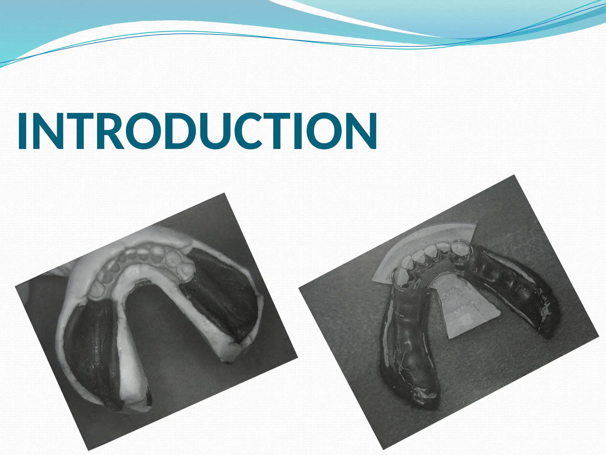 IMPRESSION TECHNIQUES IN REMIVABLE PARTIAL DENTURE | PPTX