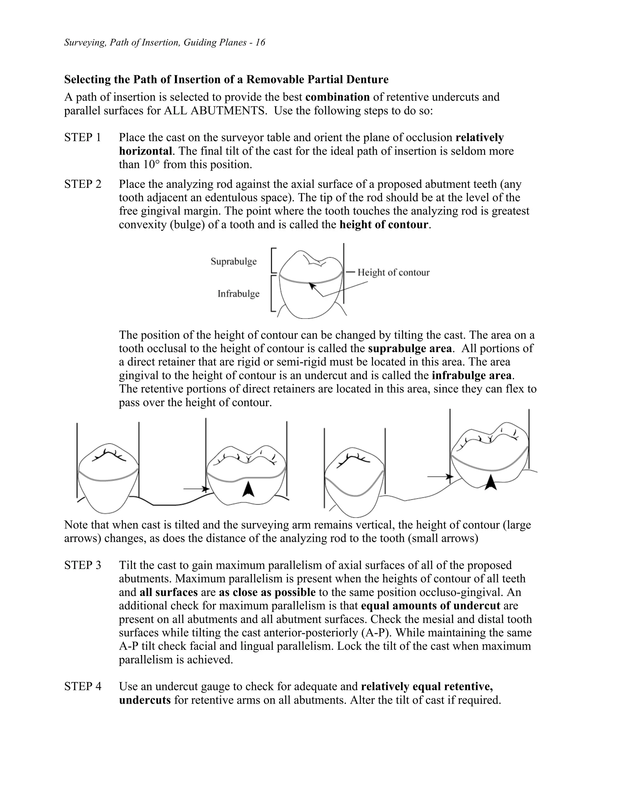 removable partial denture | PDF