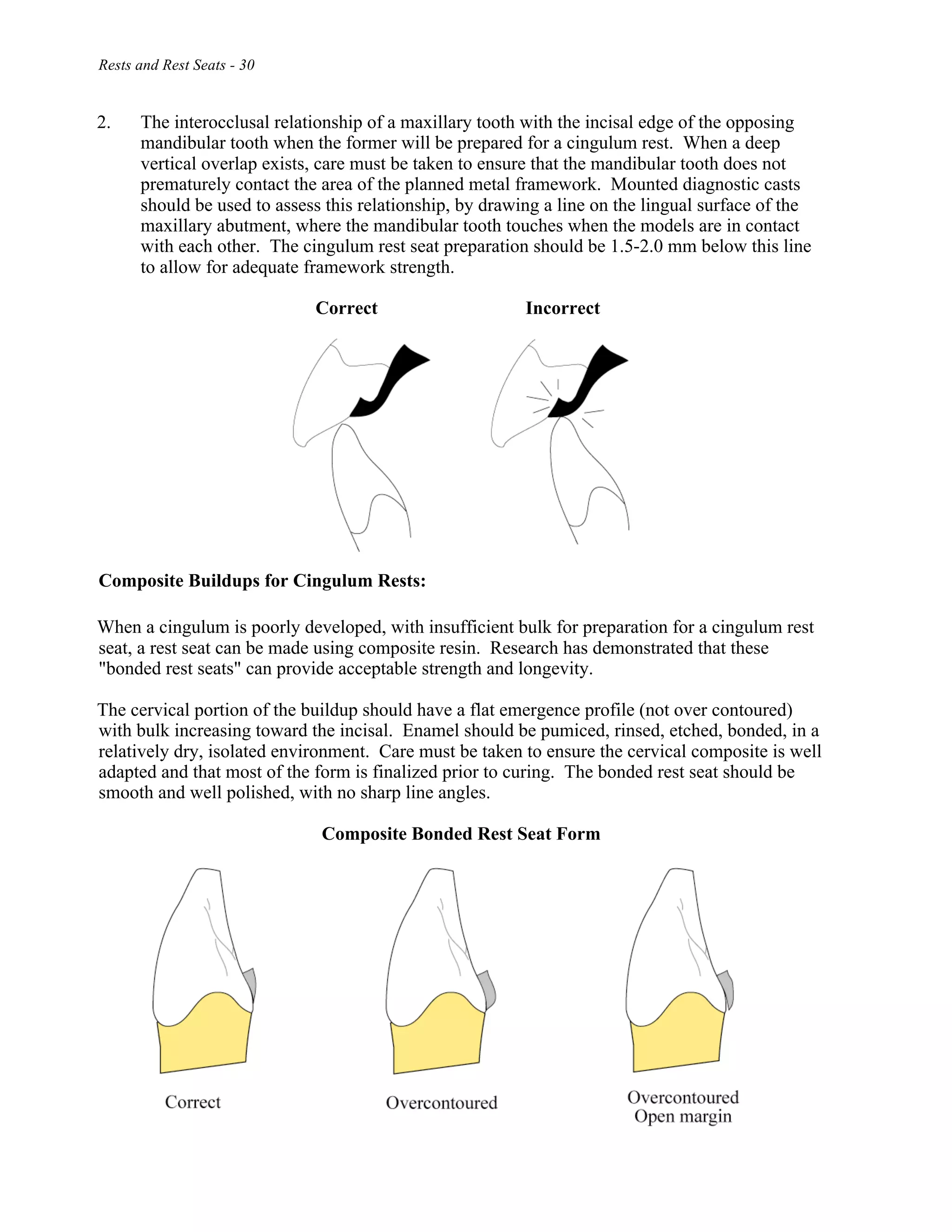 removable partial denture | PDF