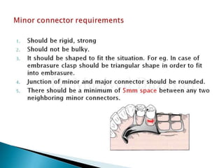 Rpd minor connectors 2nd yr | PPTX