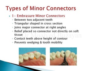 Rpd minor connectors 2nd yr | PPTX