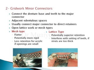 Rpd minor connectors 2nd yr | PPTX
