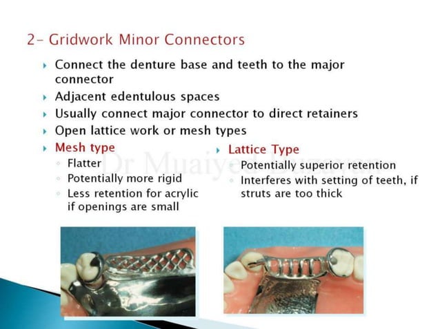 Rpd minor connectors 2nd yr | PPTX