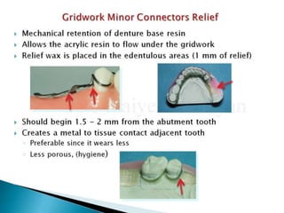 Rpd minor connectors 2nd yr | PPTX