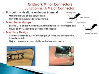 Rpd minor connectors 2nd yr | PPTX