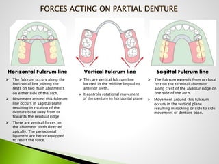 RPD DESIGN | PPTX | Dental Health | Diseases and Conditions