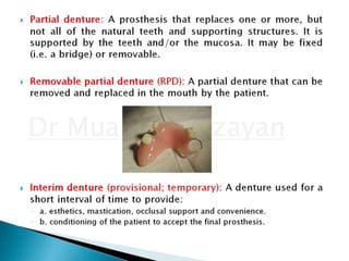 Rpd removable partial denture introduction 2nd yr | PPT