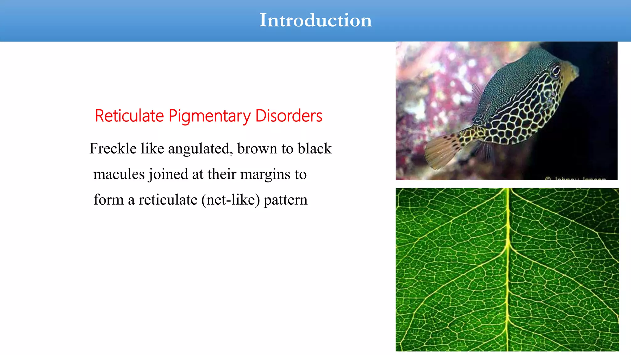 Dyschromatosis and Reticulate pigmentary disorders | PPT
