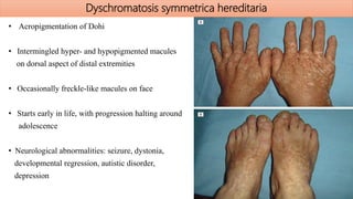 Dyschromatosis and Reticulate pigmentary disorders | PPT