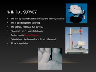removable partial denture survey lines, path of insertion, guide planes | PPT