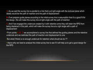 removable partial denture survey lines, path of insertion, guide planes ...