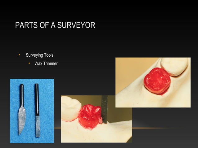 removable partial denture survey lines, path of insertion, guide planes ...