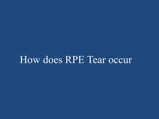RPE Tear,,,,Retinal Pigment Epithelium Tear.pptx