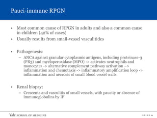 RPGN in Children.pptx