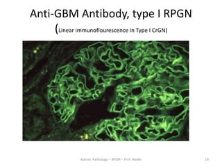 Rapidly Progressive Glomerulonephritis - renal pathology- prof wadie | PPTX