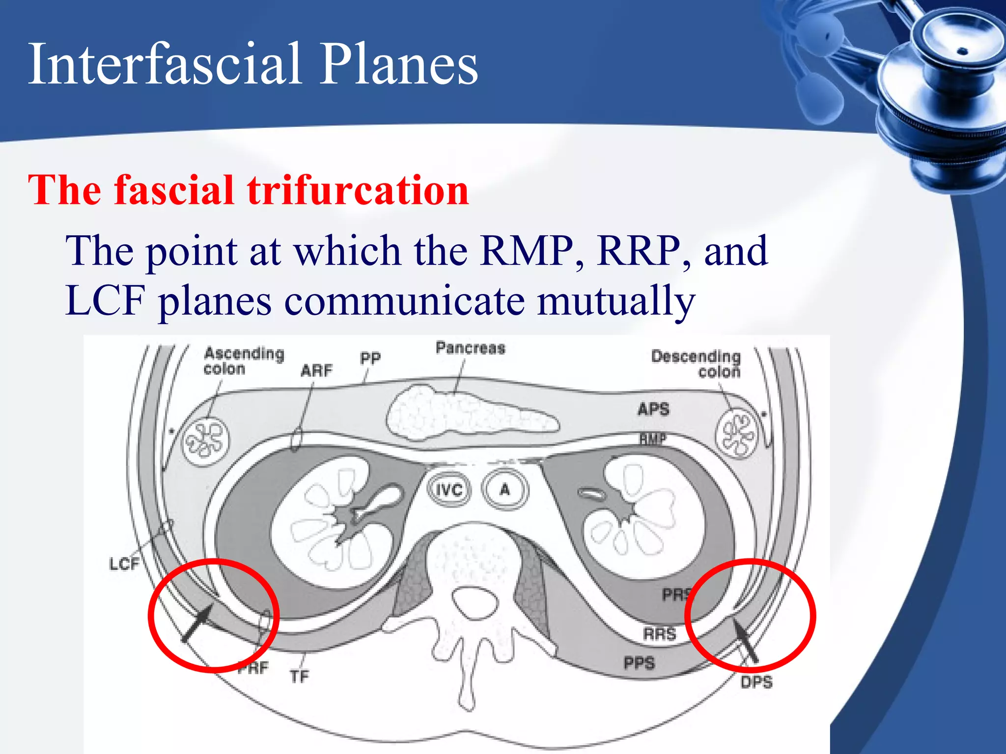 Retroperitoneal Collections | PPT