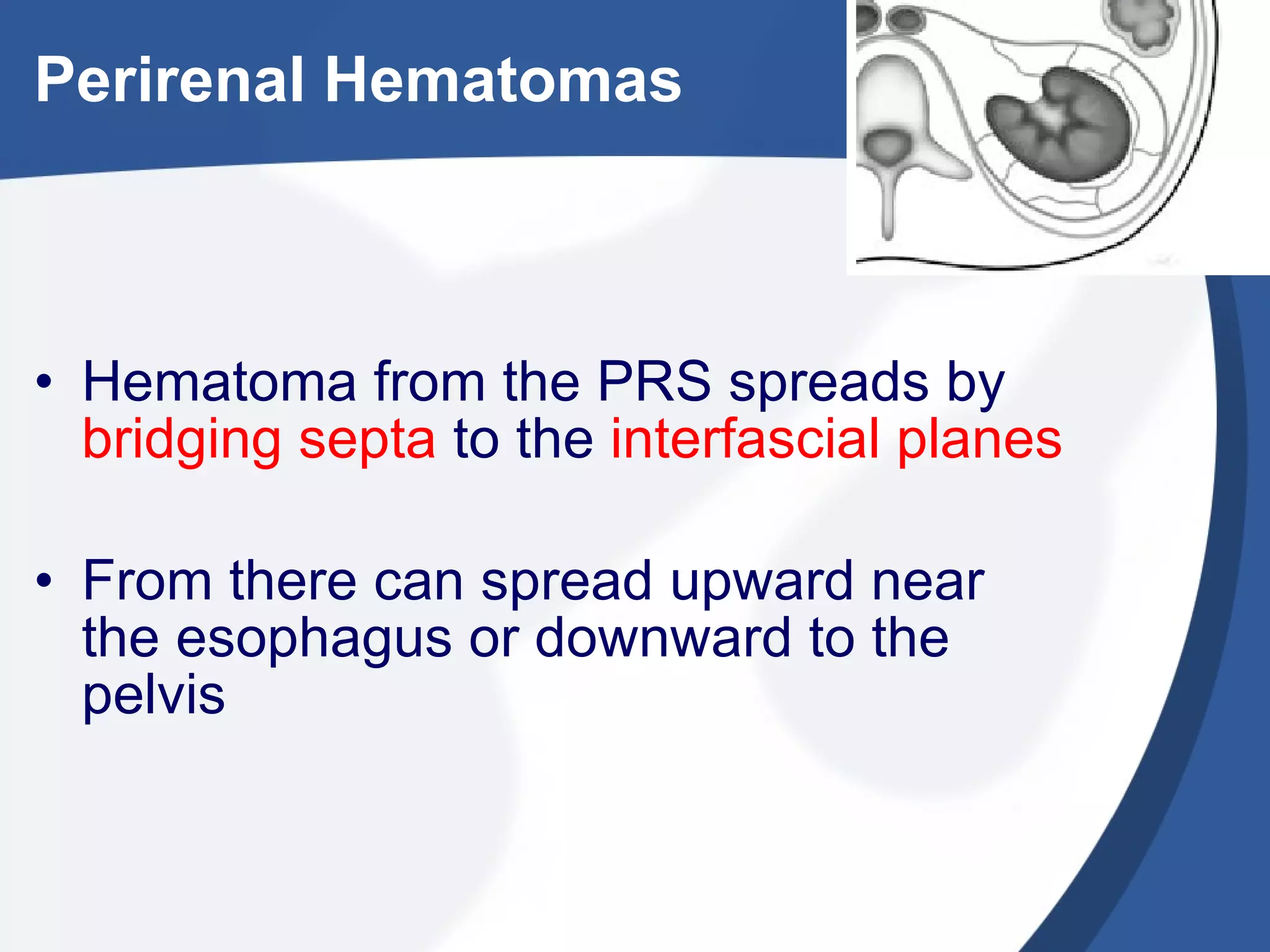 Retroperitoneal Collections | PPT