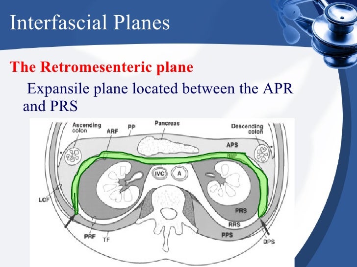Retroperitoneal Collections
