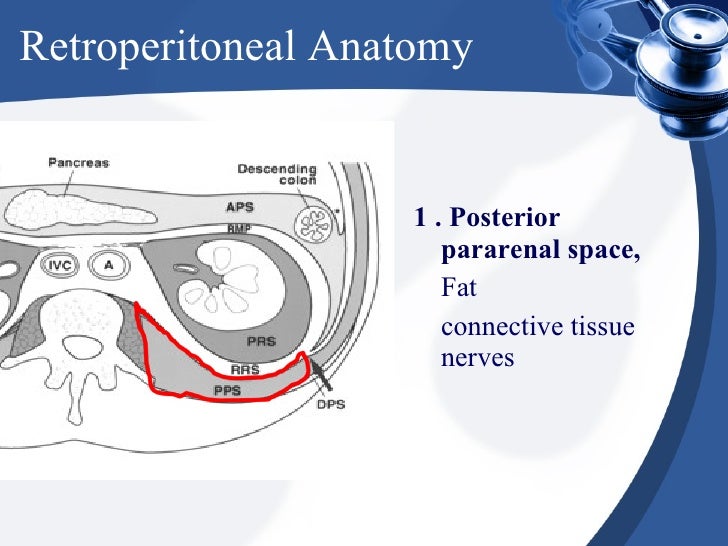 Retroperitoneal Collections