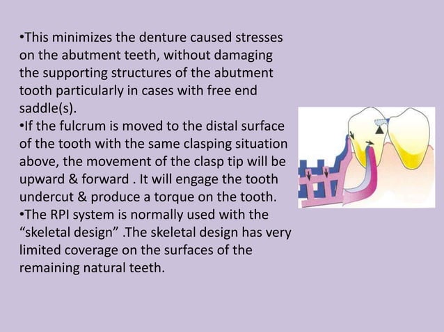 Rpi and rpa concept | PPTX