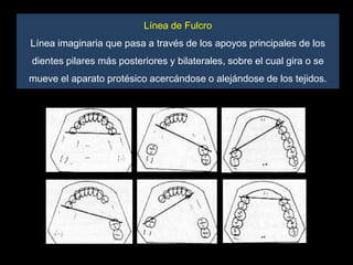 Rpi, r. indirecta, bases, prueba estructura | PPTX