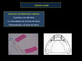 Rpi, r. indirecta, bases, prueba estructura | PPTX