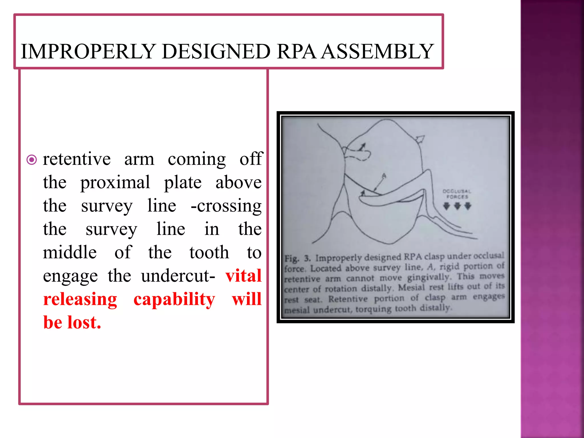 Rpi & rpa kk | PPTX | Dental Health | Diseases and Conditions