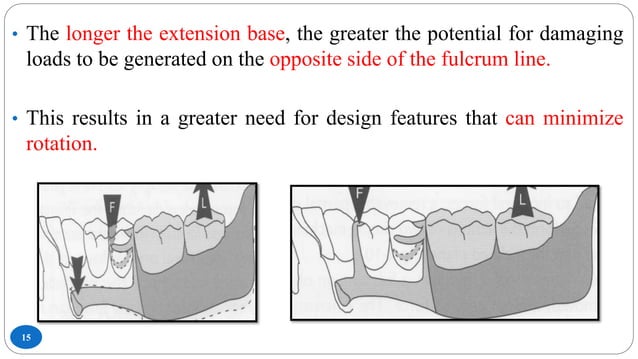 RPI & RPA system | PPTX | Dental Health | Diseases and Conditions