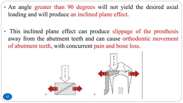 RPI & RPA system | PPTX | Dental Health | Diseases and Conditions