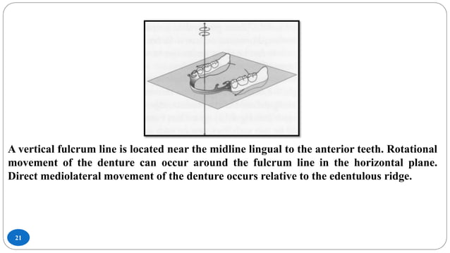 RPI & RPA system | PPTX | Dental Health | Diseases and Conditions