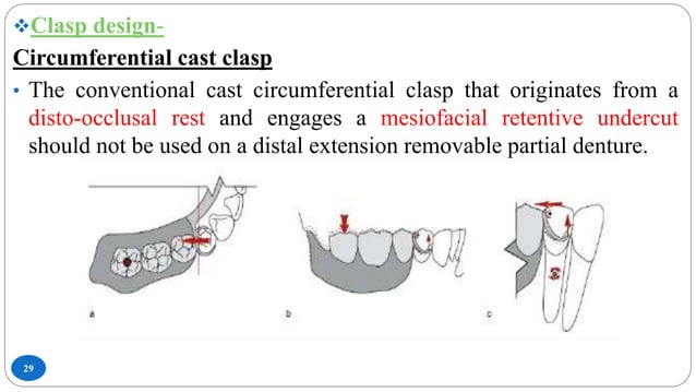 RPI & RPA system | PPTX | Dental Health | Diseases and Conditions