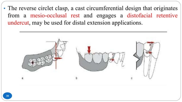 RPI & RPA system | PPTX | Dental Health | Diseases and Conditions
